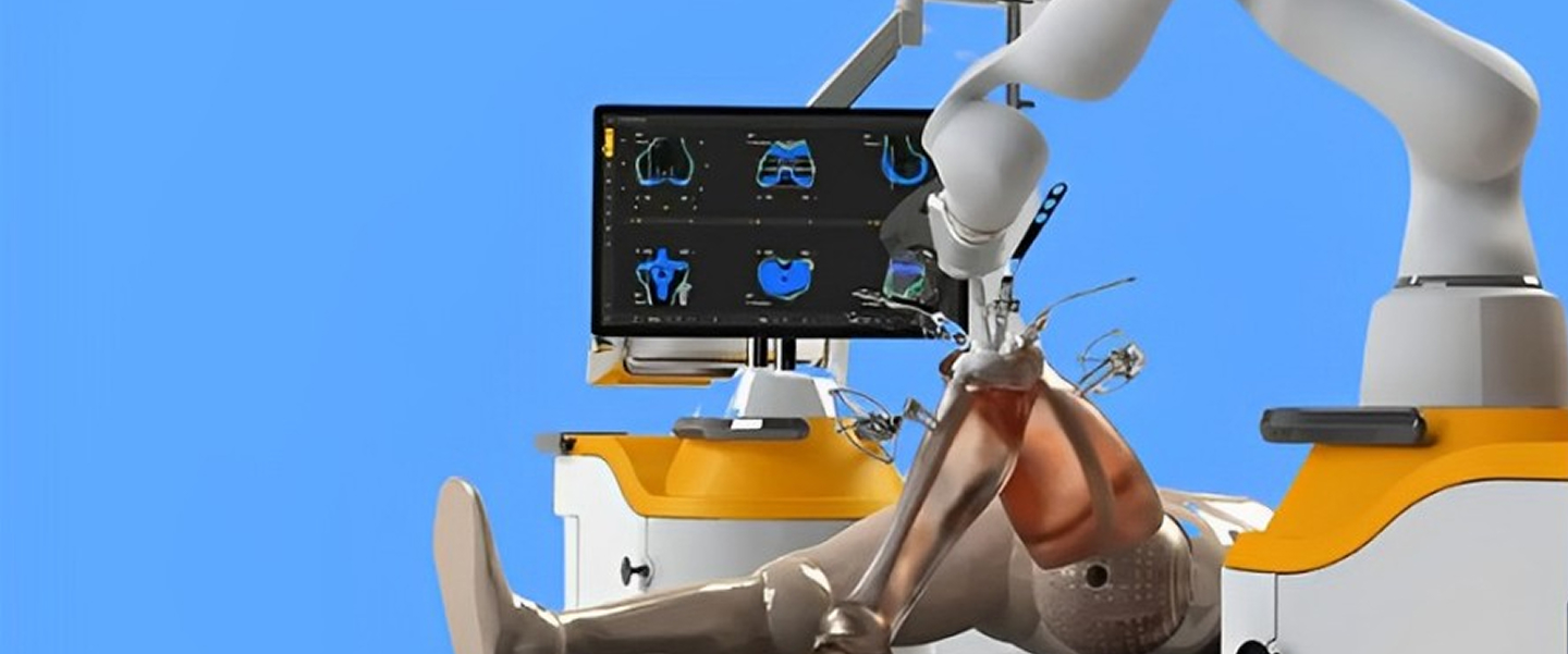 Robotic Knee Replacement Surgery